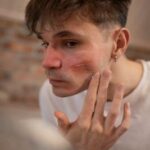 Degloved Face - Radar Magazine